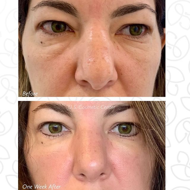 Services - Us Cosmetic Center - U.S. Cosmetic Center