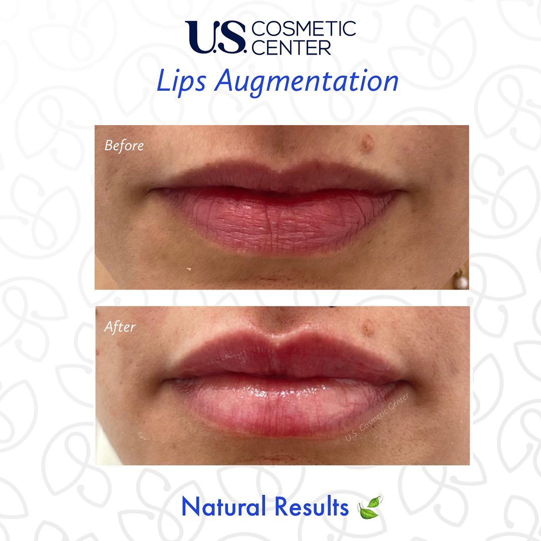 #1 Medical Spa Orlando - U.S. Cosmetic Center